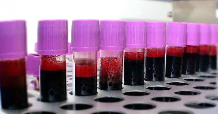 發現將“A”型血轉化為通用“O”型的酶