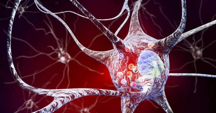 Tutkimus tarjoaa uusia todisteita siitä, että Parkinsonin tauti on peräisin suolistosta