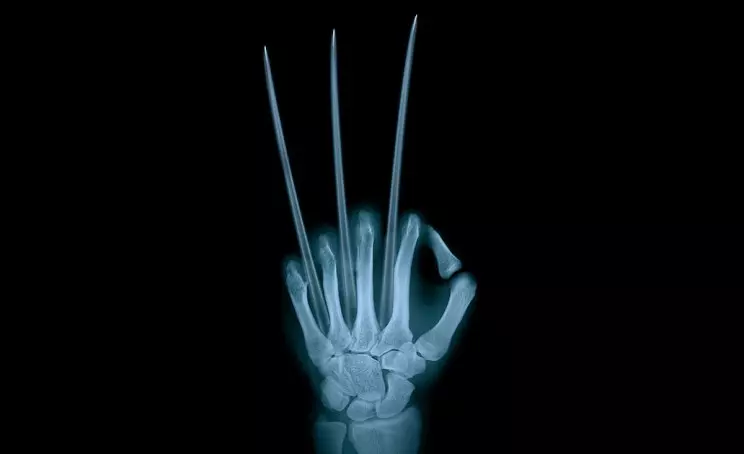 Una schiuma di metallo simile a un osso mostra proprietà curative simili a Wolverine