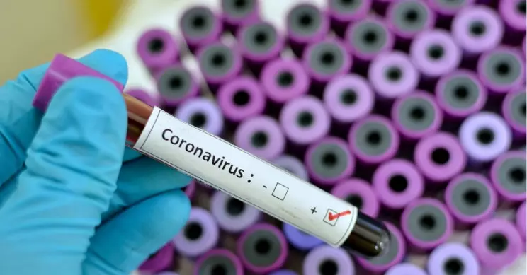 Ekwupụtala ikpe ise nke ọrịa Coronavirus na US