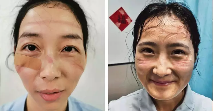 Smilende ansigter af medicinsk personale i Wuhan efter at have behandlet coronavirus-patienter i timevis