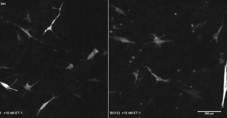 Hûdsellen emitearje neuron-like bursts In protte as harsensellen, ûndersyk fynt