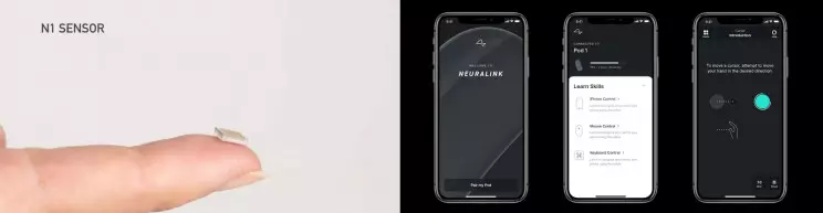 Sťahovanie ľudského mozgu do počítača: Elon Musk's Neuralink