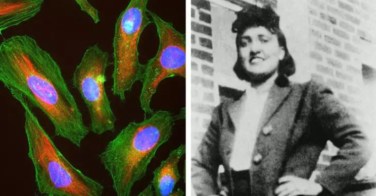 Người đàn bà bất tử: Thiếu Henrietta và Tế bào HeLa