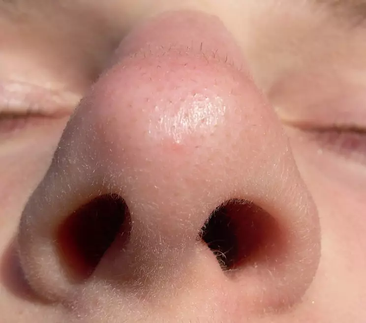 コロナウイルスの神話の鼻