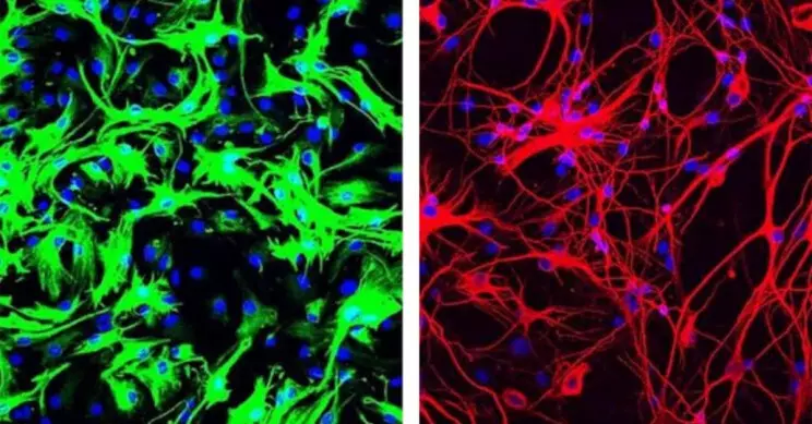 Pangobatan Neuron Hiji-waktos Ieu Ngabalikeun Panyakit Parkinson dina Beurit