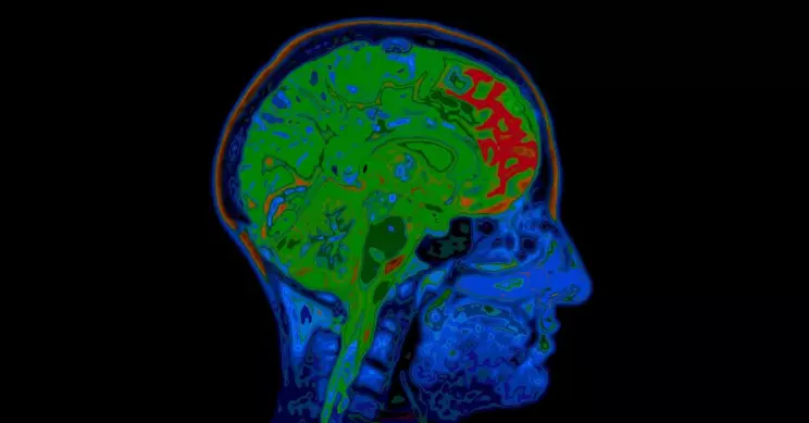 Individuele neuronen helpen ons beslissingen te nemen op basis van geheugen, zegt Study