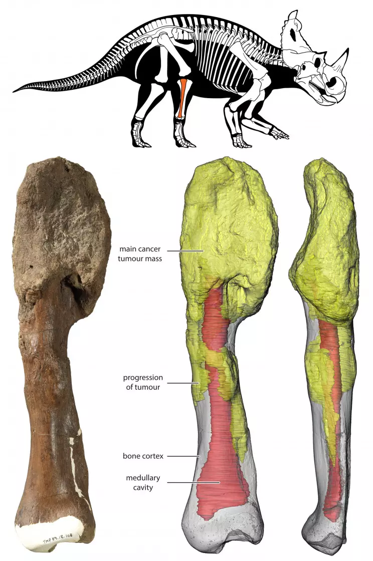 Ilmuwan Telah Mendiagnosis Dinosaurus Dengan Kanker Ganas Dalam Sejarah Pertama