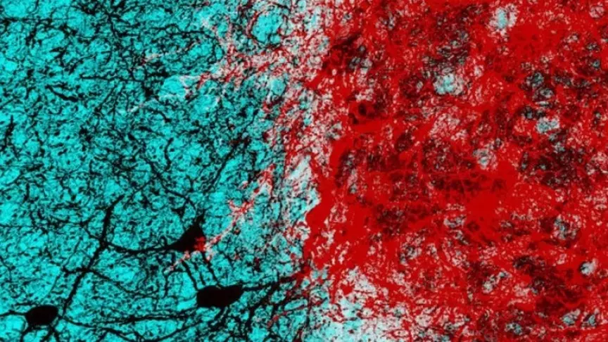 Wani Sabon Zamani: Masana Kimiyya Sun Yi Nasarar Dasa Jikin Embryonic Neurons