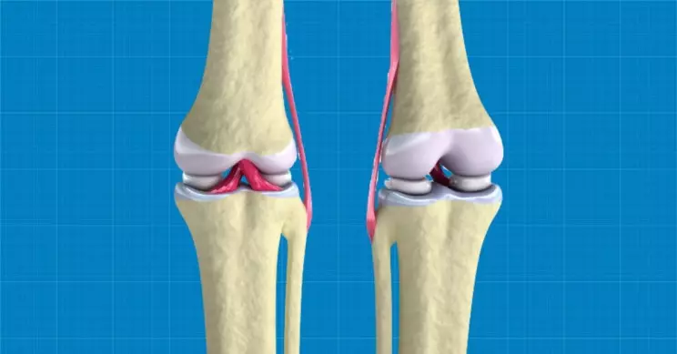 Ndị ọkà mmụta sayensị 3D-Bioprint Regenerative Knee Cartilage Tissue