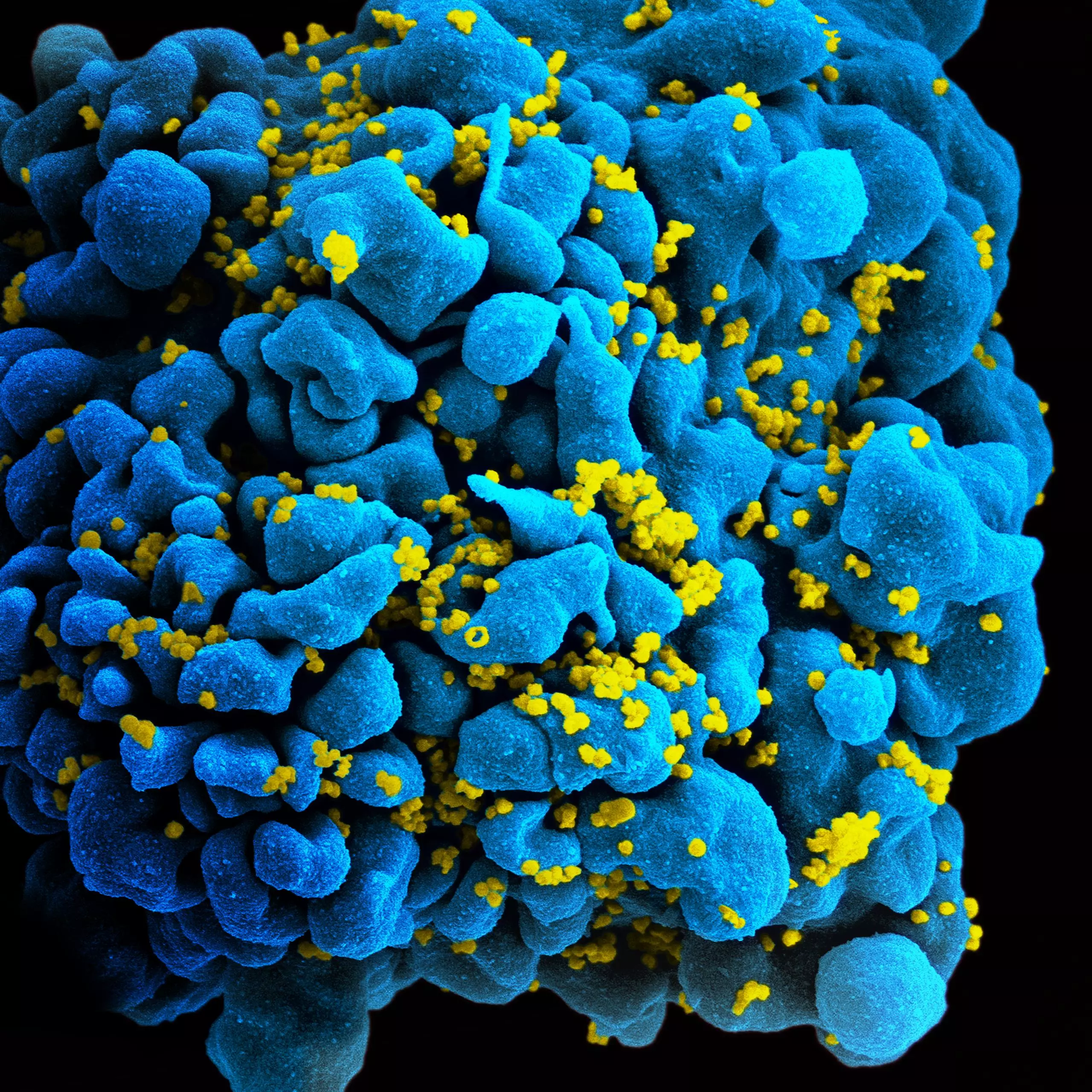 I-H9 T-cell eyosulelwe yi-HIV