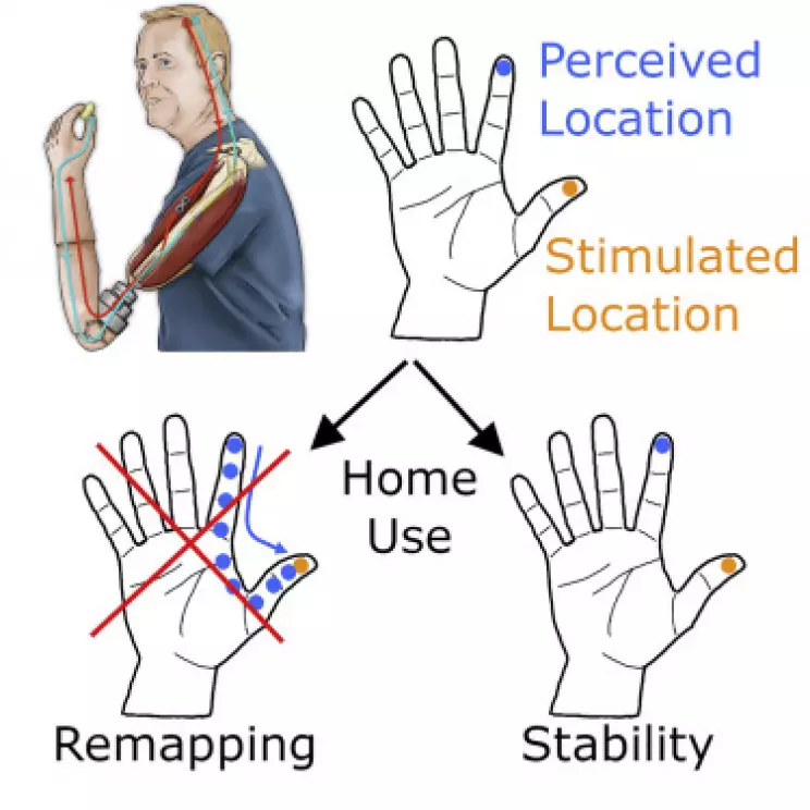 ọpọlọ prosthetic aṣamubadọgba