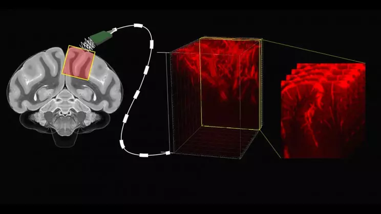 Ultrasound Imaging Technique Inobvumira Masayendisiti Kuverenga Pfungwa