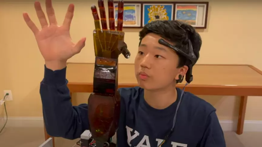 हाई स्कूल के एक छात्र ने कृत्रिम हाथ बनाया जिसे वह अपने दिमाग से नियंत्रित करता है। एआई का उपयोग करना?