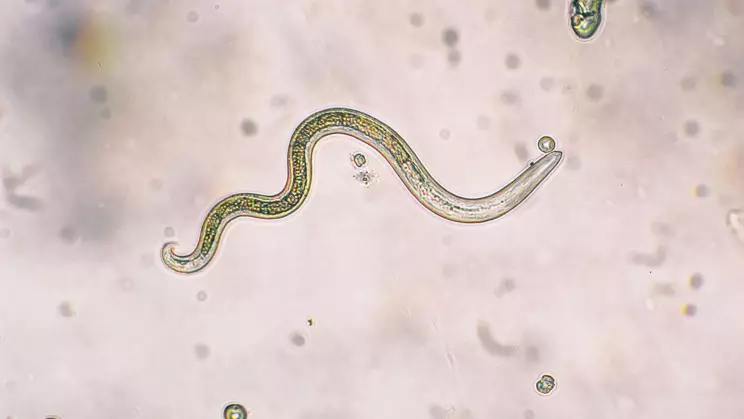 Geneticky modifikované drobné červy dokážu odhaliť rakovinu pankreasu v ranom štádiu