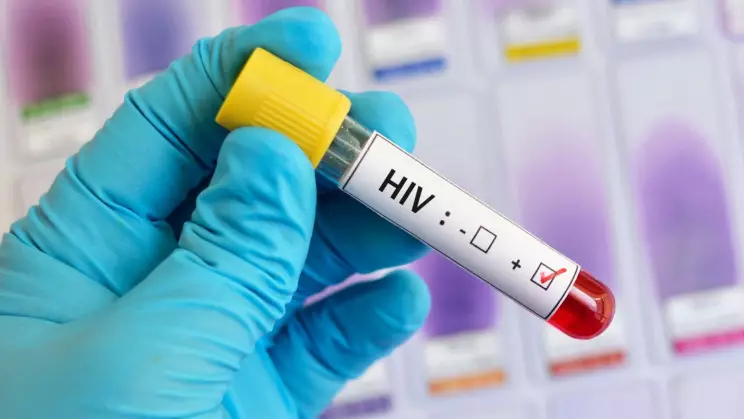 Läbimurdeline ravi, mis võib HIV-i välja juurida, et alustada inimkatseid