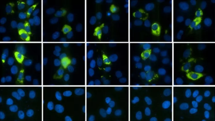 科学家使用纳米抗体检测所有类型的埃博拉病毒