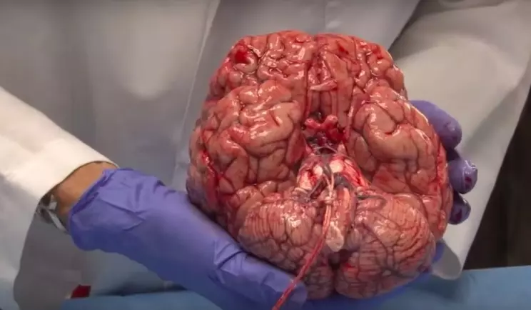 kirie onye Neuroanatomist ji ụbụrụ dị ọhụrụ n'aka ya kọwaa ụbụrụ mmadụ