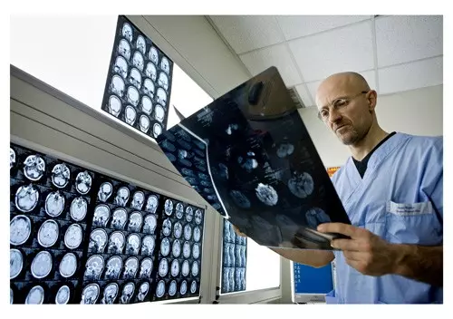 Kiistanalainen neurokirurgi väittää tehneensä maailman ensimmäisen ihmisen päänsiirron
