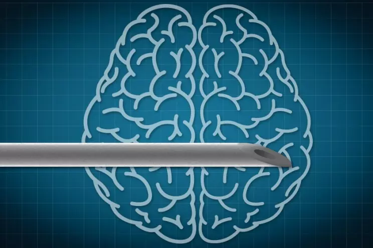 Panaliti MIT Ngembangkeun Implan Médis Leutik pikeun Digunakeun dina Ngalawan Balukar tina Gangguan Neurologis Tinangtu