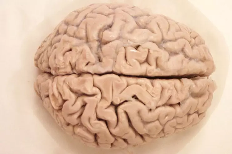 MIT-ը խզում է կապերը ուղեղի վերբեռնման հակասական ստարտափի հետ