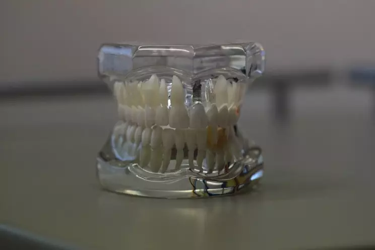 Ang Medicine Infused 3-D Printed Dentures Fight Infections