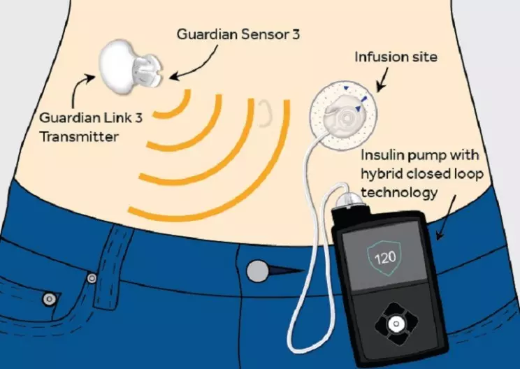 15 Sensors Biometric ah oo ku jira shaqada kuwaas oo bedeli doona diiwaannada caafimaadka oo ogaan doona xanuunada ugu caansan