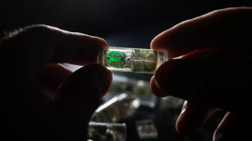 Ilmuwan Kembangkan 'Bakteri pada Keripik' yang Dapat Mendiagnosis Pendarahan Lambung