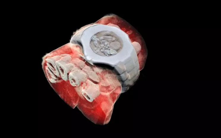 Pierwsze na świecie kolorowe zdjęcia rentgenowskie 3D ludzkiego ciała wyprodukowane przy użyciu technologii CERN