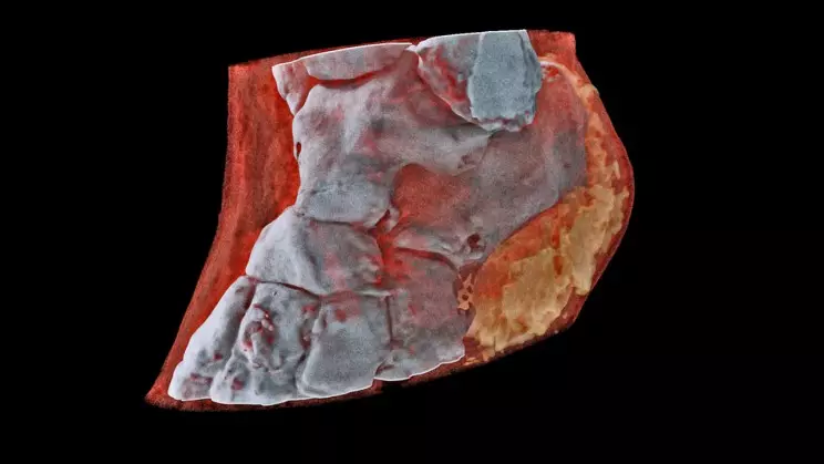 Os primeiros raios-X 3D coloridos do corpo humano do mundo produzidos usando a tecnologia CERN