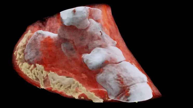 Prvi 3D barvni rentgenski žarki človeškega telesa na svetu, izdelani s tehnologijo CERN