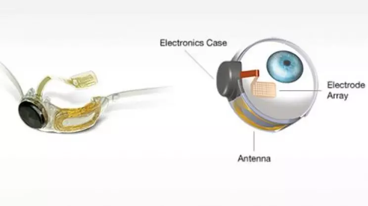 bionično oko
