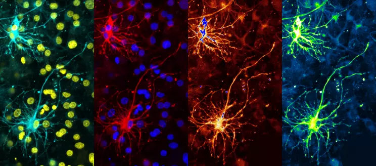 Neuralink: Ki jan sèvo imen an pral telechaje dirèkteman nan yon òdinatè