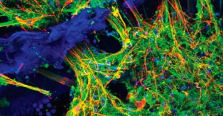 Naukowcy wykorzystują komórki macierzyste do wzrostu funkcjonującej tkanki mózgowej 3D
