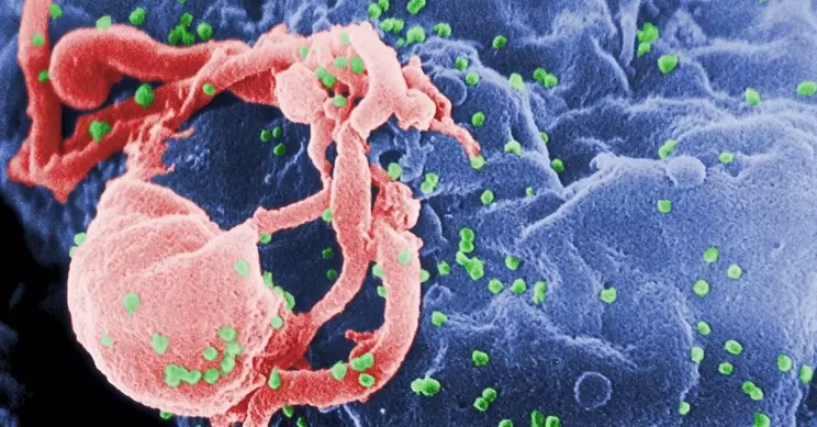 อุปกรณ์พกพาให้โซลูชันต้นทุนต่ำในการตรวจหาเชื้อเอชไอวี