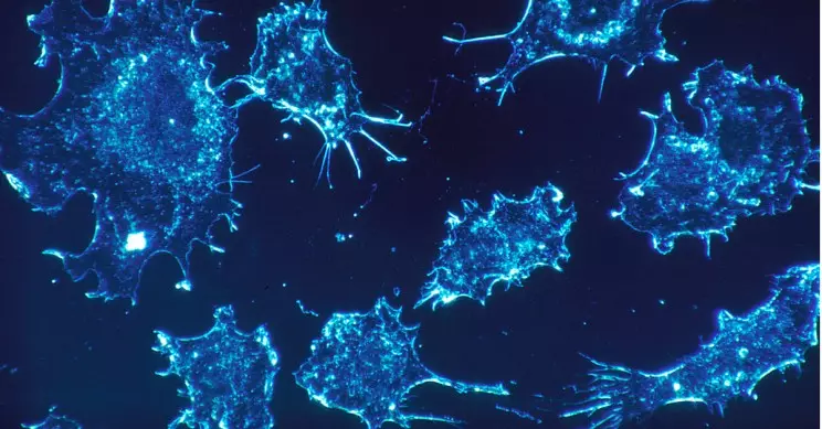 تقنية واعدة جديدة تعتمد على النانو للكشف عن السرطان