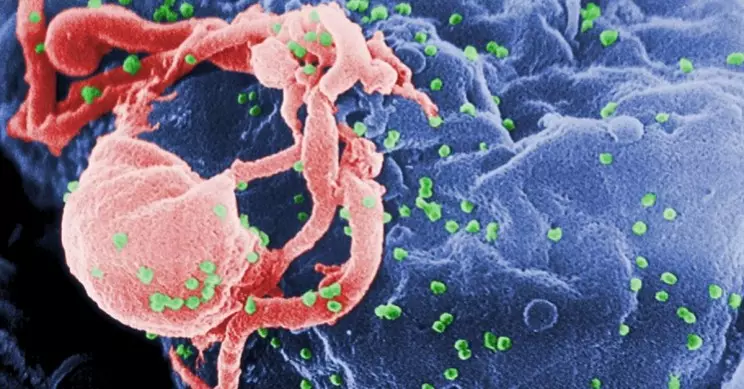AIDS-kutatók felfedezték a HIV-fertőzött sejtekben a gyenge láncszemet