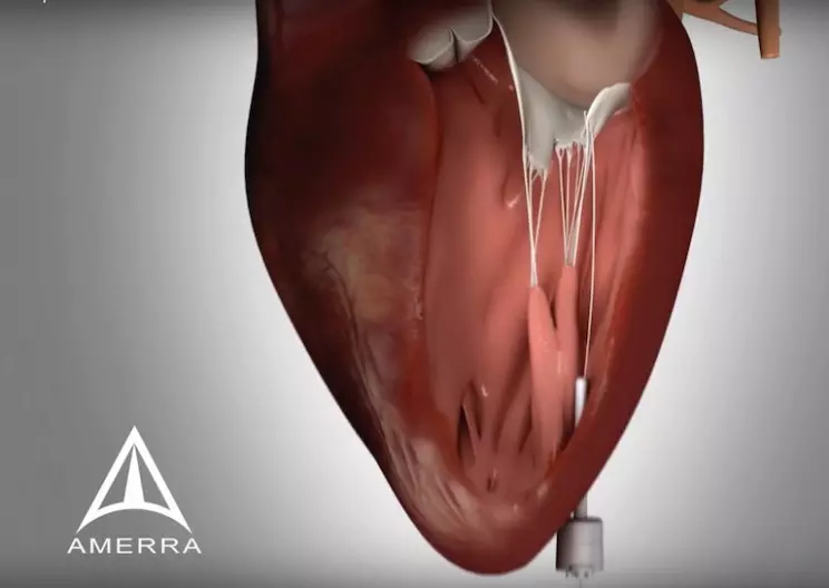 Heart Harpoon Repairs Hearts Sûnder invasive sjirurgy
