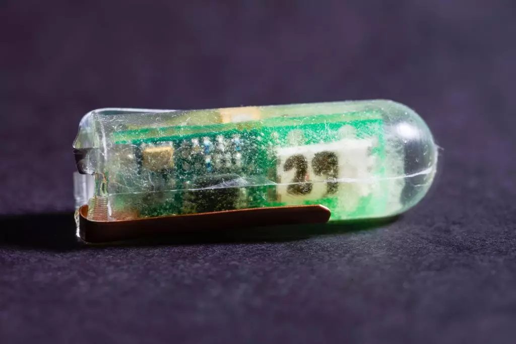 Овај мали уређај за праћење здравља који се може прогутати покреће стомачне киселине