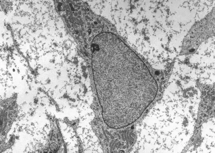 Le super matériau graphène pourrait être la clé de la régénération des cellules nerveuses