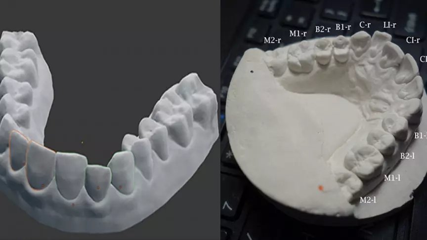 Kollegestudent 3D druk goedkoop selfdoenhouers om sy skewe tande reg te maak