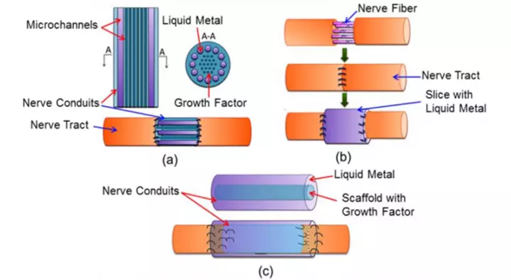 nervepair