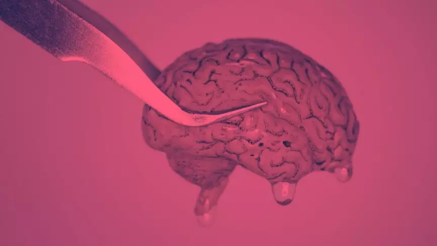 49 Interesanti fakti un stāsti par cilvēka smadzenēm
