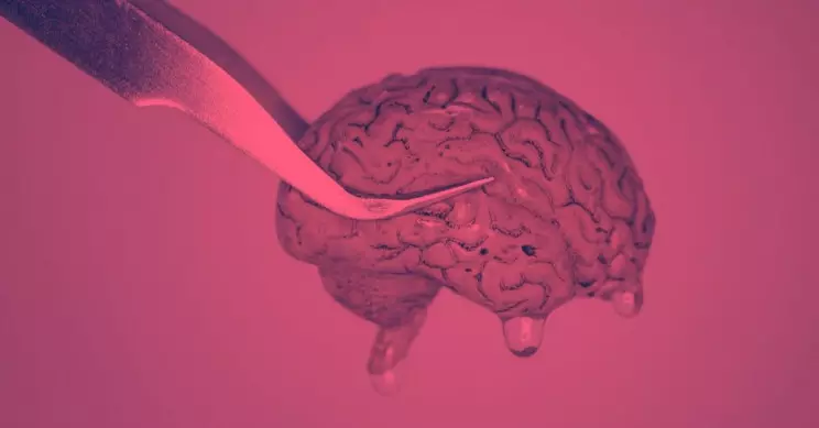 49 Zanimiva dejstva in zgodbe o človeških možganih