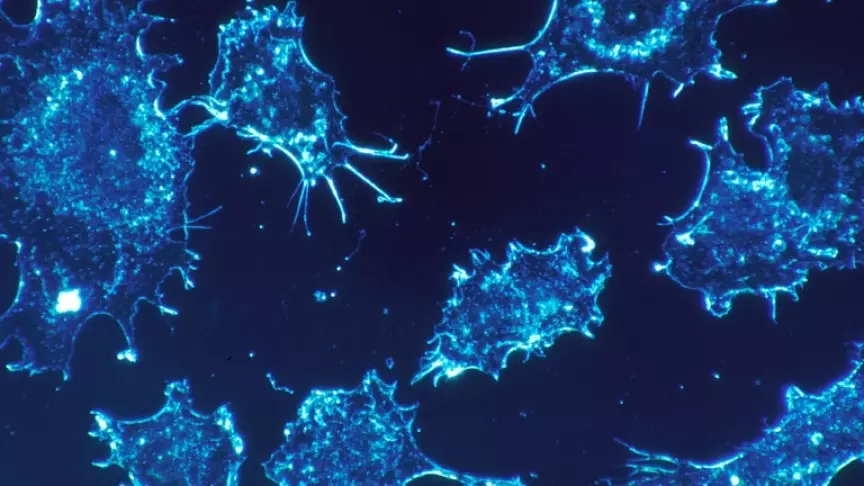 Tieto nanočastice ničia rakovinové bunky